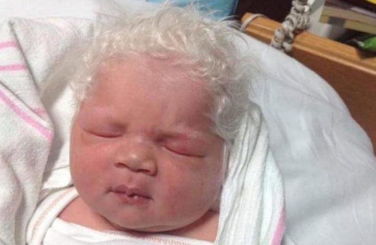 Baby with gray hair! How he looks now? – Vibes Corner