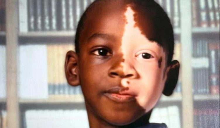 This unique boy accepted his appearance . Here is how he looks now ...