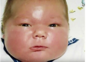 In 1983, a 16-pound gigantic infant made news; today he’s all grown up ...