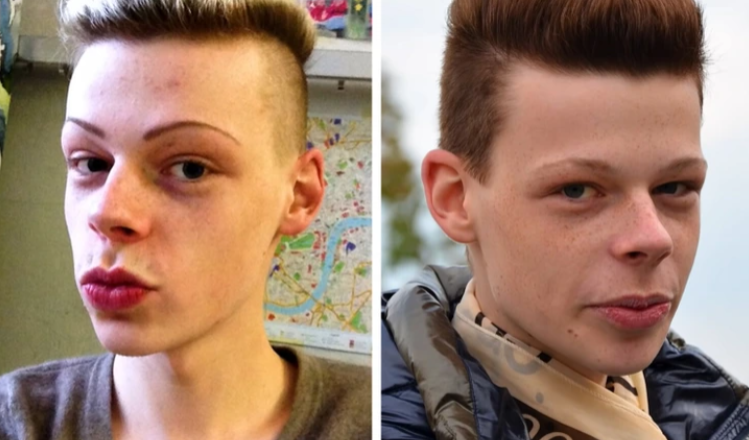 Meet Patrick Mast, Who Spent $73,000 To Look Like A Doll, But Wait ...