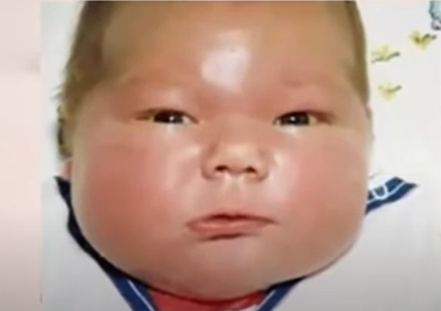 In 1983, a 16-pound enormous infant made headlines; today, he’s grown ...